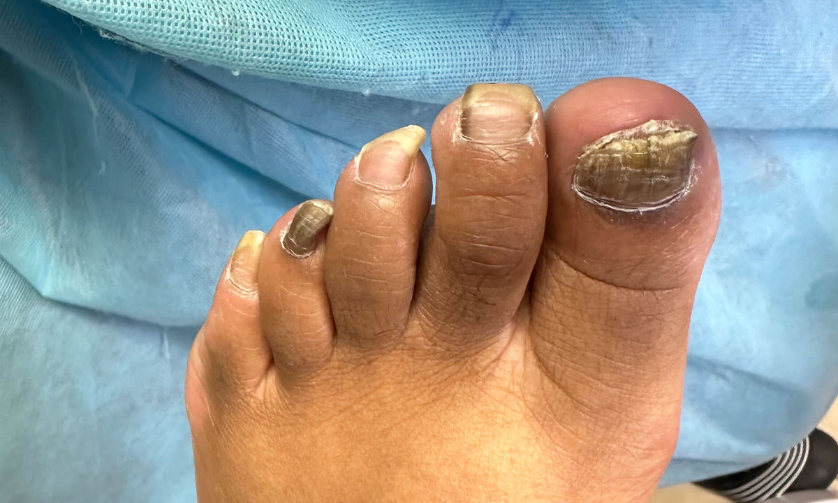 Brand New Feet Medical Foot Spa – Brand New Feet